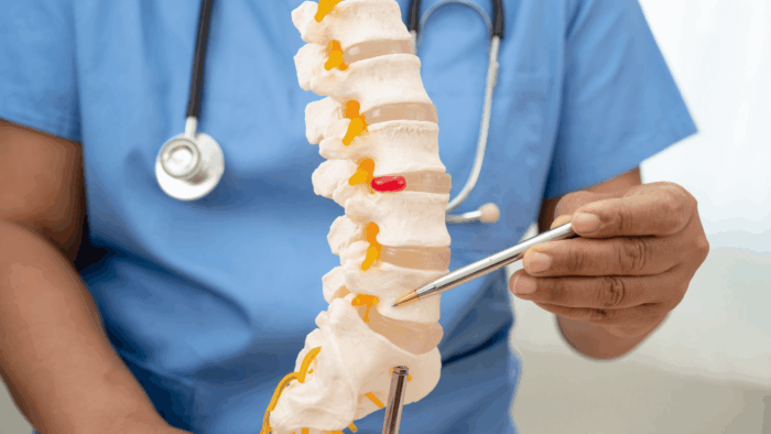 Why Your Sciatica Keeps Coming Back and What Actually Helps